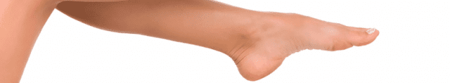 Retrocalcaneal Bursitis - PhysioWorks!